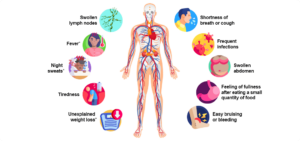 Symptoms and Diagnosis – NHL Strive