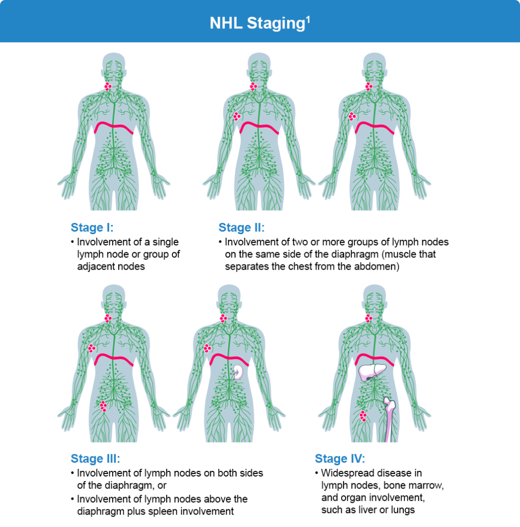 Symptoms and Diagnosis – NHL Strive